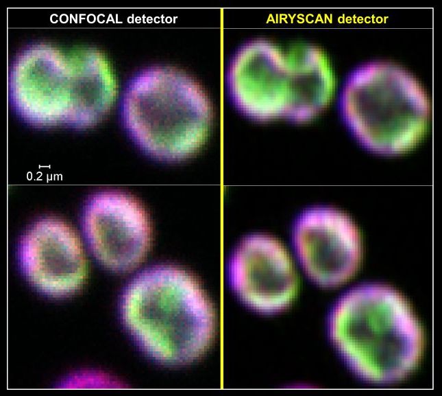 Confocal Microscopy